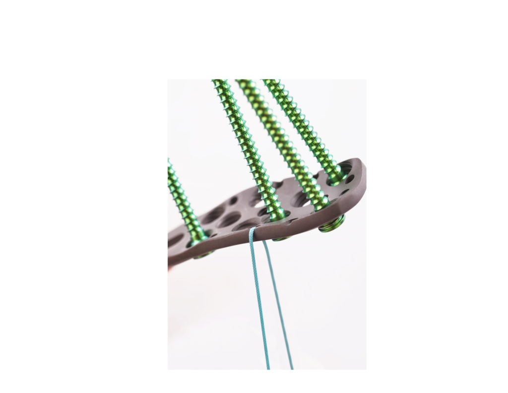 Vortex Proximal Humerus plate - Sanatmetal